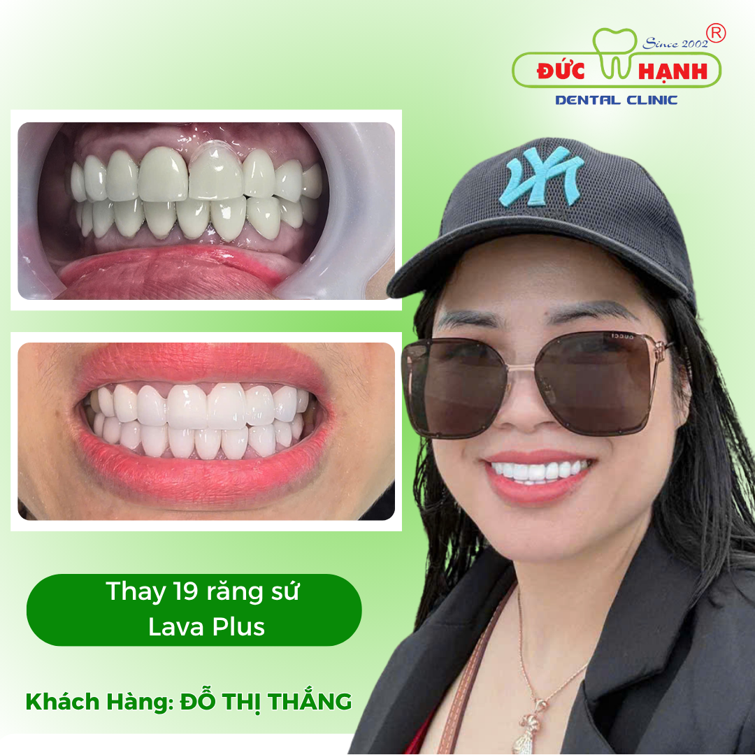 Nha Khoa Đức Hạnh